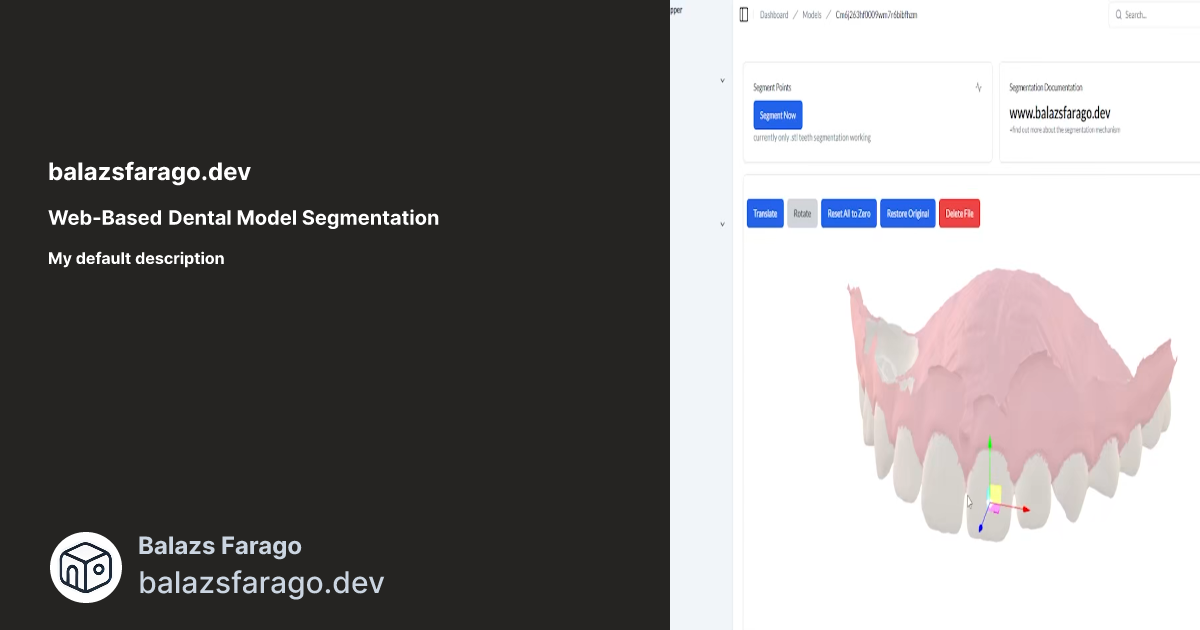 Web-Based Dental Model Segmentation